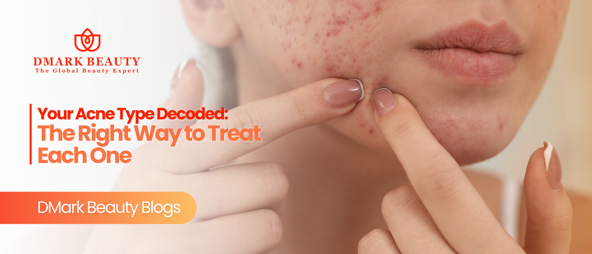Your Acne Type Decoded: The Right Way to Treat Each One – Dmark Beauty