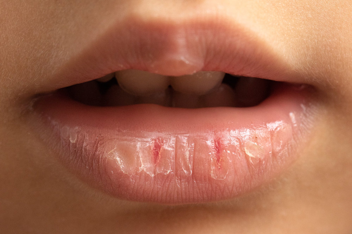 Ultimate Guide to Smooth and Hydrated Lips – Dmark Beauty